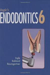 Ingle’s Endodontics, 7th Edition