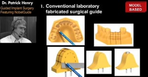 Guided Implant Surgery Featuring NobelGuide