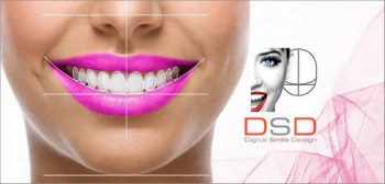 Digital Smile Design (DSD) Course