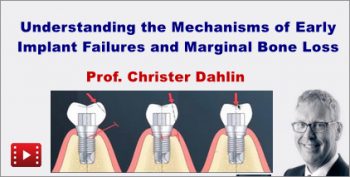 Understanding the Mechanisms of Early Implant failures