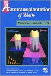 Autotransplantation of Teeth