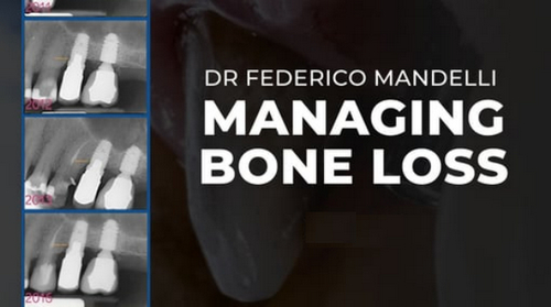 Managing Bone Loss (2 Lectures)