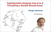 Cephalometric Analysis from A to Z: Everything a Dentist Should Know